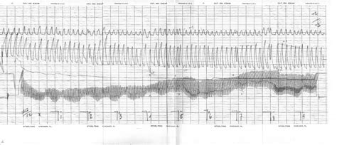 News News About Polygraphs Voice Stress Analyzers And Other Purported Lie