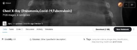 Ai For Healthcare Project Using Nvidia Jetson Nano 2gb Developer Kit Building Project From