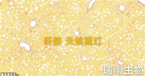 天狼猩红染色 上海瑞雨生物科技有限公司