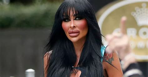 Botched Star And Australias Katie Price Shows Off Huge Transformation