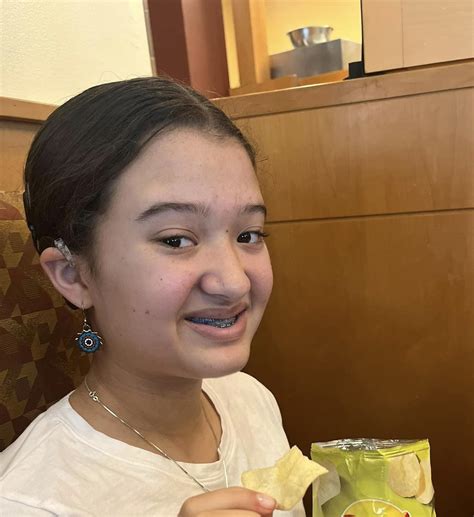 Sienna Pediatric Cochlear Implant Review Unc Otolaryngology Head And