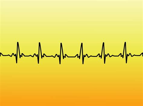 Ecg Vector At Vectorified Com Collection Of Ecg Vector Free For Personal Use