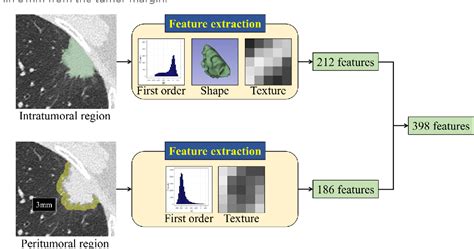 Figure 1 From Role Of Intratumoral And Peritumoral Ct Radiomics For The Prediction Of Egfr Gene