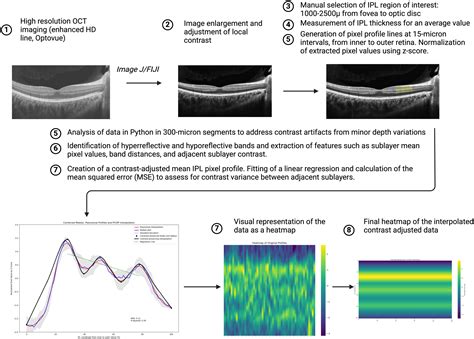 Inner Plexiform Layer Substrata Are Discernible With Commercial Oct And Affected By Aging