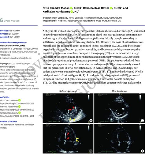 A B Inferolateral And Apical Wall Thickening In Short Axis And Download Scientific Diagram