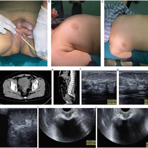 Flowchart For 46XY DSD Differential Diagnosis DSD Disorders Of Sex Download Scientific Diagram