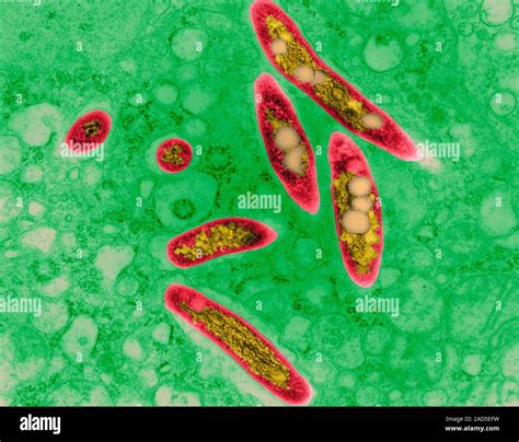Coloured Transmission Electron Micrograph Tem Of Mycobacterium Avium Complex Mac Infection