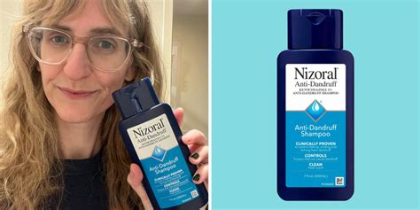 This Genius Anti Dandruff Shampoo Saved My Itching Bleeding Scalp