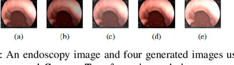 Figure 2 From Automatic Classification Of Upper Gastrointestinal Tract