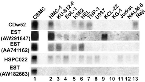 Rna Blot Hybridization Analysis Each Lane Contains 10 Wg Of Total Rna Download Scientific