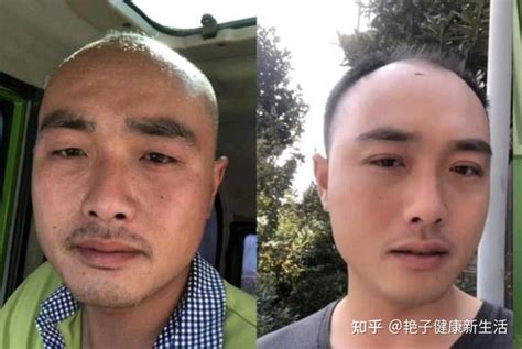 男人45岁后是否有“油腻感”？2个特征，不妨自查，做好2点或有用 知乎
