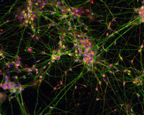 Medium Spiny Neurons Zakian Lab Ipsc Collection