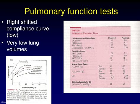 Ppt Chapter 5 Diffuse Interstitial Pulmonary Fibrosis Powerpoint Presentation Id 6401261