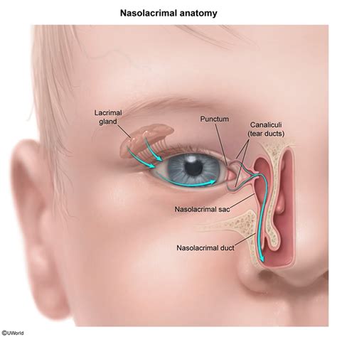 Dacryocystitis Ophthalmology Uworld Medical Library