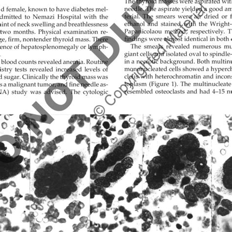Various Types Of Osteoclastlike Multinucleated Giant Cells