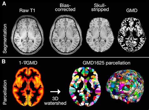 Age Related Effects And Sex Differences In Gray Matter Density Volume Mass And Cortical Age Related Effects And Sex Differences In Gray Matter Density Volume Mass And Cortical