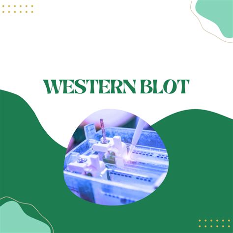 O Que São Células Caliciformes Cursau Educação Blog