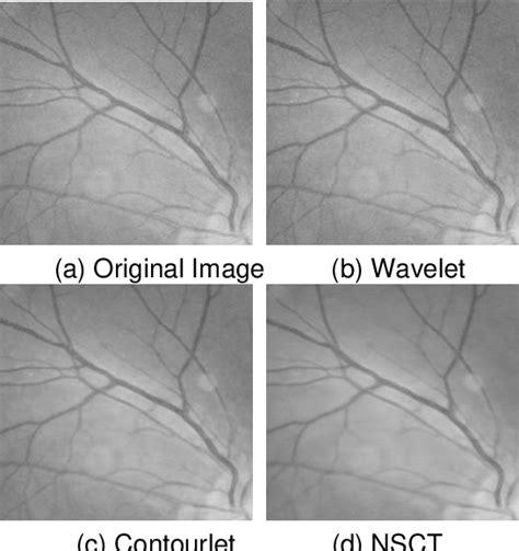 figure 3 from an improved recognition algorithm for retina texture