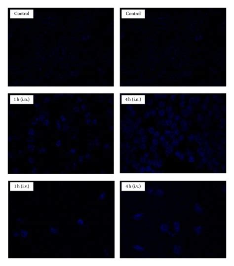 Qualitative Localization Of Dapi Loaded Plga Nanoparticles In Brain Download Scientific Diagram