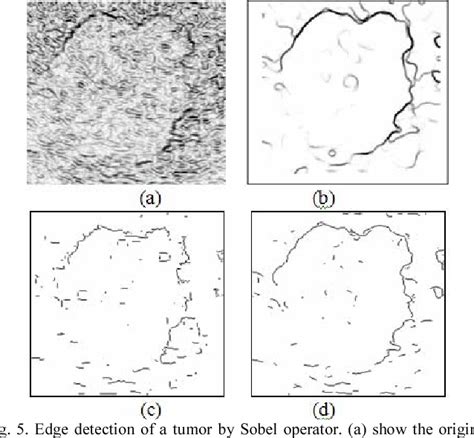 Figure 1 From Reduced Speckle Noise On Medical Ultrasound Images Using