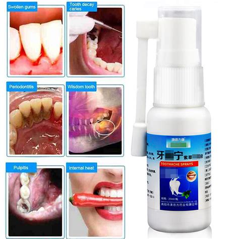 Toothache Pain Relief Teeth Care Sprays Effective Dental Tooth Pain