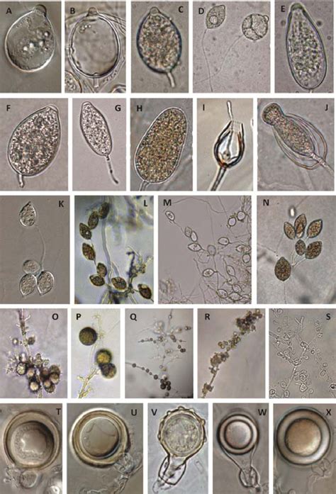 Morphological Features Of Phytophthora Species Asexual And Sexual