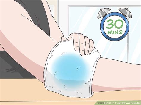 3 Ways To Treat Elbow Bursitis Wikihow Health