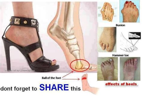 LOOK At The Absurdity Of These Kinds Of Shoes And How They RUIN Your Feet And Your Back From