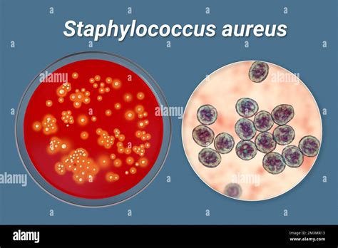 Bacteriological Analytical Manual Chapter 12 Staphylococcus Aureus At