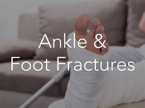 Frisco Ankle Foot Fractures Frisco Foot Ankle Specialists