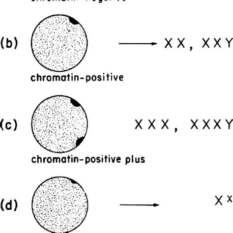 Pdf Diagnosing Sex Chromatin
