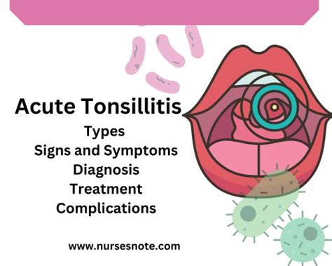 Acute Tonsillitis Types Signs And Symptoms Diagnosis Treatment