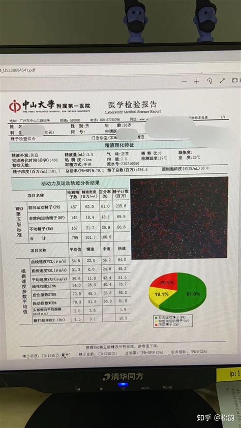 一次精液检查经历 知乎