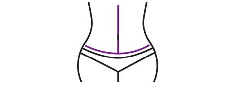 Abdominoplasty Sydney Natural Tummy Tuck By Dr Illie