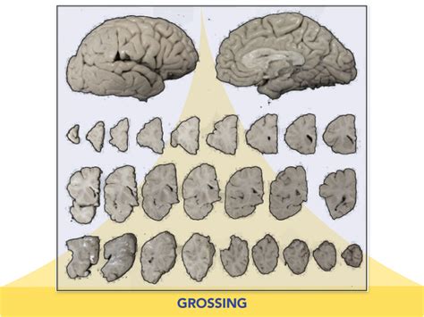 Histopathology Tissue Processing Services Seqmatic