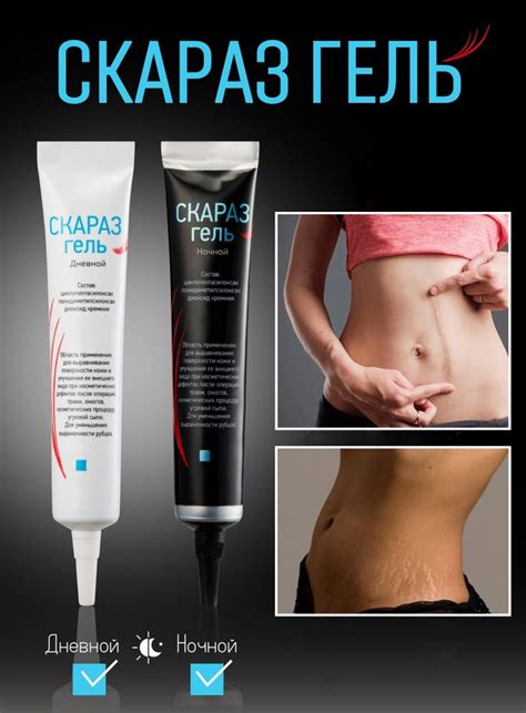 Не будет на теле больше шрамов, растяжек и рубцов! Выравнивает ...