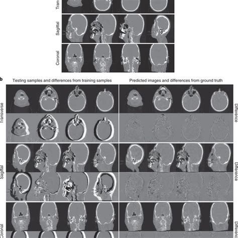 3d Image Reconstruction With Ultra Sparse Projection View Data A A