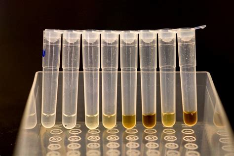 Dna Isolation 5 Free Photos On