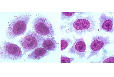 Multidrug Resistant Organisms Mdros Growing Spreading And Killing