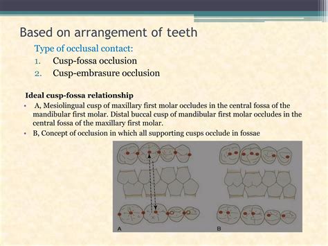 Occlusion In Dentistry Pptx Dental Health Diseases And Conditions