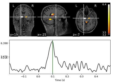 Compute Mne Inverse Solution On Evoked Data With A Mixed Source Space