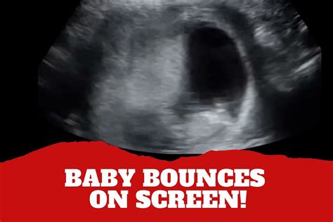 Couple Caught Having Sex On Cable Car In Guayaquil Marca Tv English