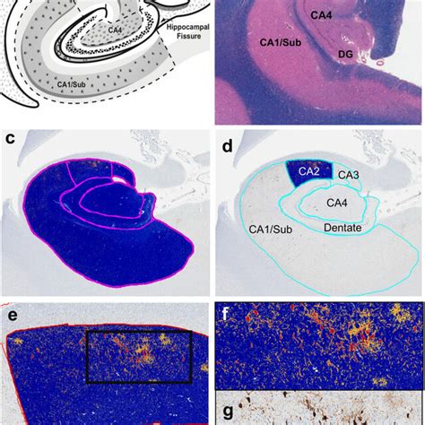Neuroanatomical Segmentation Strategy And P Tau Burden Quantification Download Scientific