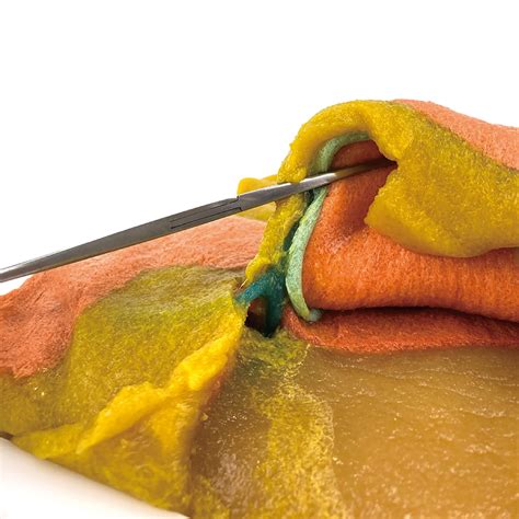 Vtt Laparoscopic Distal Gastrectomy Model【vtt Ldg】 Kotobuki Medical Surgical Training Models