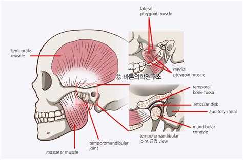 턱관절장애 측두하악장애 Temporomandibular Joint Disorder Metamedic