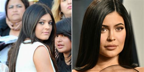 Did Kylie Jenner Have Plastic Surgery Check Out These Before After Photos Where She Looks