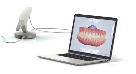 Intraoral Scanners Market Is Projected To Expand At A 7 6 Cagr And Reach Usd1 5 Billion By 2034