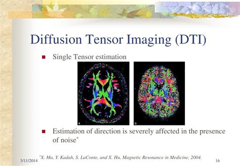 Ppt Diffusion Tensor Mri And Fiber Tacking Powerpoint Presentation