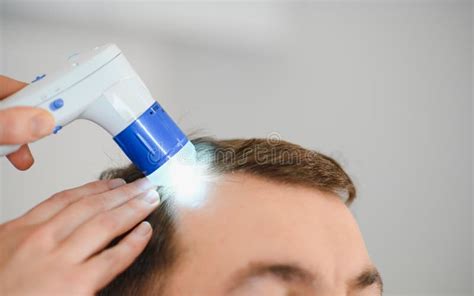 Female Doctor Looks At A Mans Scalp With A Dermatoscope Diagnosis Of Scalp Condition By A