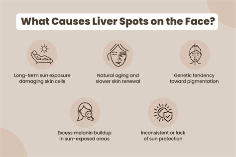 Liver Spots On Face Causes Treatment And Removal Healthkart
